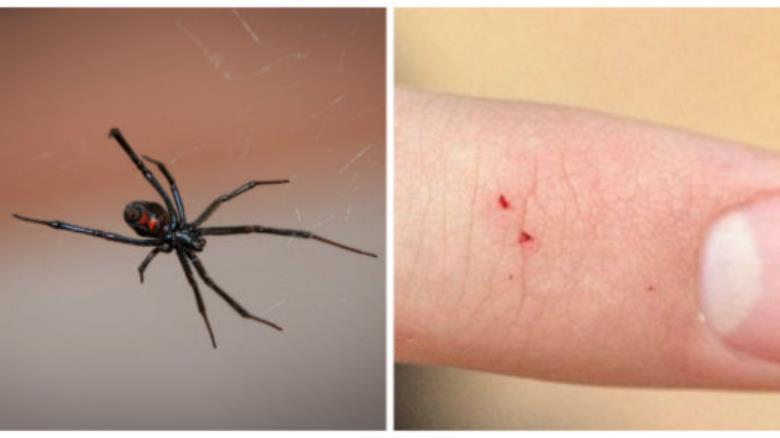 How to Identify a Spider Bite and Treat It